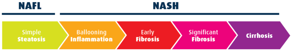 Hepatitis, NASH...What are the different liver diseases?